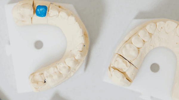 Simple Guide To Implant Impression Coping Techniques